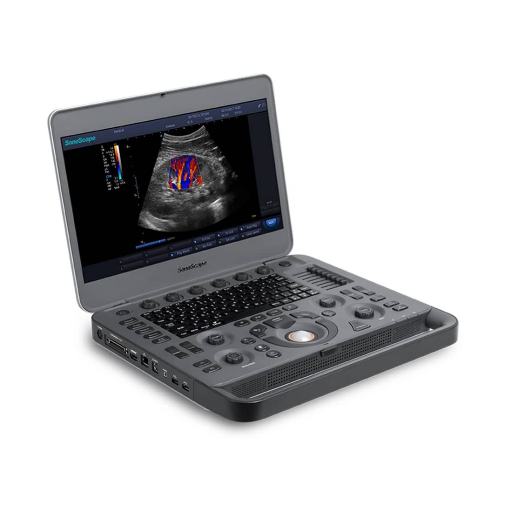 Ecógrafo Hitachi Arietta 850 - Insanex